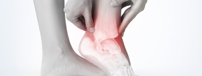Common Foot and Ankle Injuries - Orthopedic & Sports Medicine