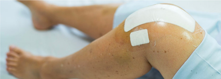 Answers To Common Questions About Knee Replacement Surgery Orthopedic answers-to-common-questions-about-knee-replacement-surgery-orthopedic