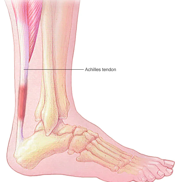 Podiatry– Foot & Ankle Specialist - Orthopedic & Sports Medicine