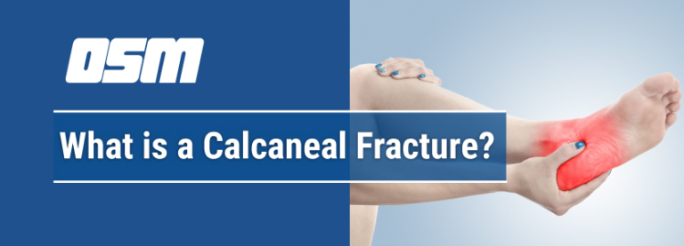 What is a Calcaneal Fracture? - Orthopedic & Sports Medicine