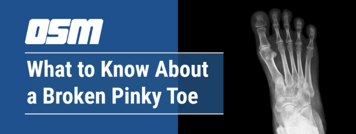 What to Know About a Broken Pinky Toe - Orthopedic & Sports Medicine