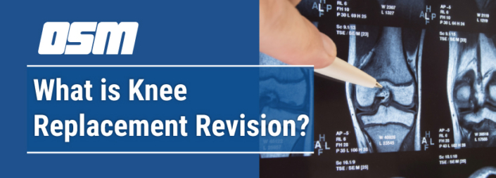 What is a Knee Replacement Revision? - Orthopedic & Sports Medicine