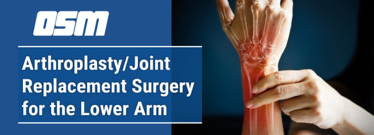 Arthroplasty/Joint Replacement Surgery for the Lower Arm - Orthopedic ...
