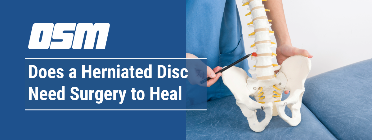 Does a Herniated Disc Need Surgery to Heal? - Orthopedic & Sports Medicine