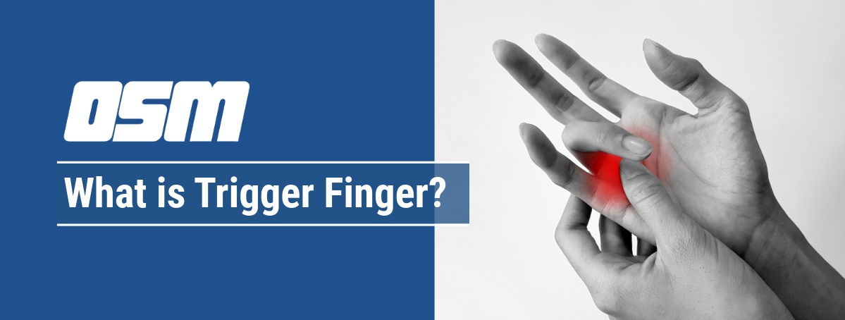 What is Trigger Finger? - Orthopedic & Sports Medicine