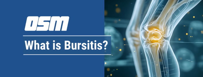 What is Bursitis? - Orthopedic & Sports Medicine