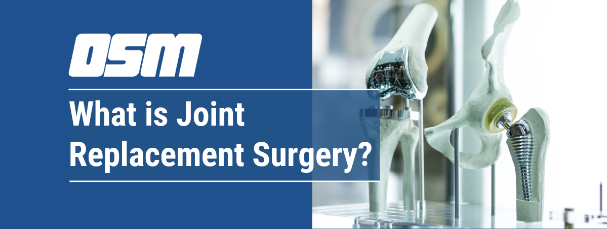 What is Joint Replacement Surgery? - Orthopedic & Sports Medicine