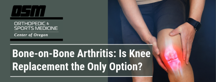 Bone-on-Bone Arthritis: Is Knee Replacement the Only Option ...