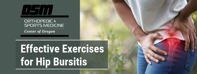 Effective Exercises for Hip Bursitis - Orthopedic & Sports Medicine