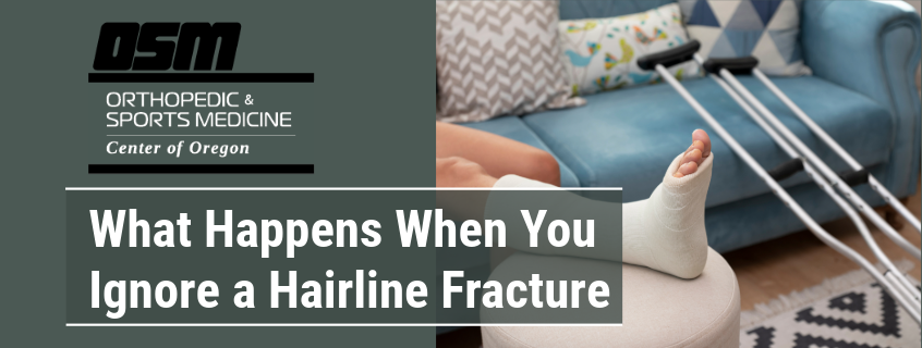 What Happens When You Ignore a Hairline Fracture - Orthopedic & Sports ...