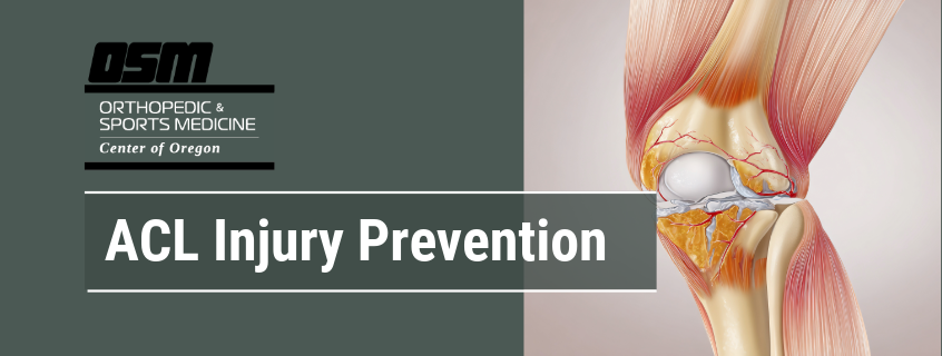 ACL Injury Prevention - Orthopedic & Sports Medicine